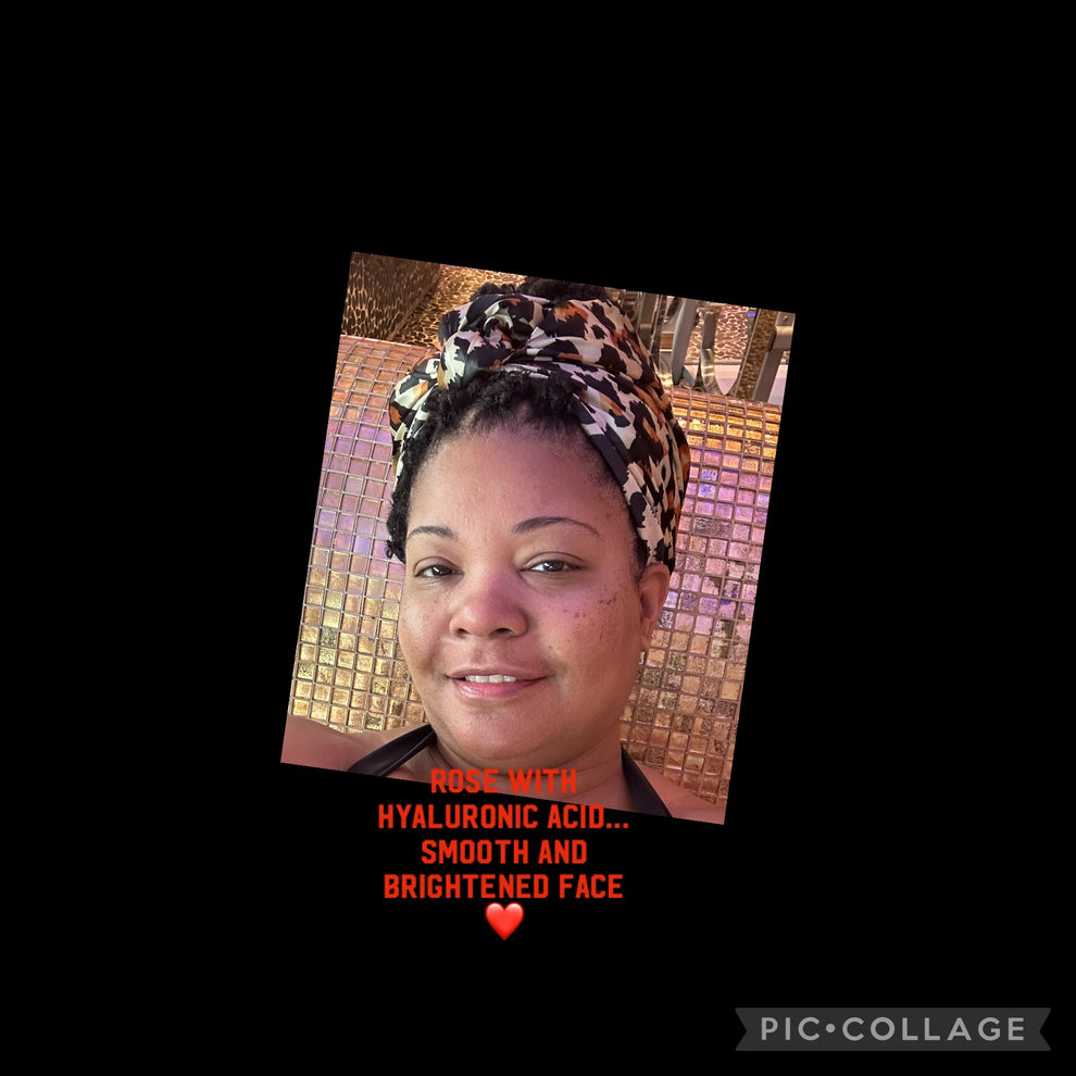 Daily Moisture Boost Serum- Unisex. Our Preservative Free Rose Water/H ...